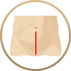 Da Vinci Xi Surgical System1